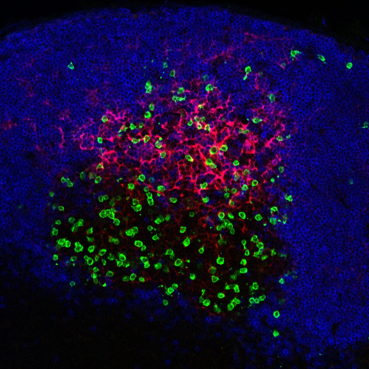MBS Seminar - "Advancing therapeutic intervention to overcome treatment resistance and ...